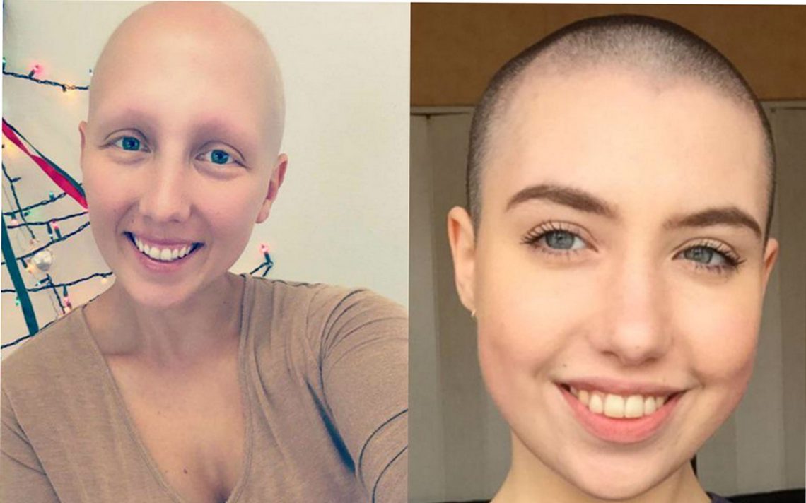 #BaldandBadChallenge : elles assument leur crâne rasé - Femmes du Maroc